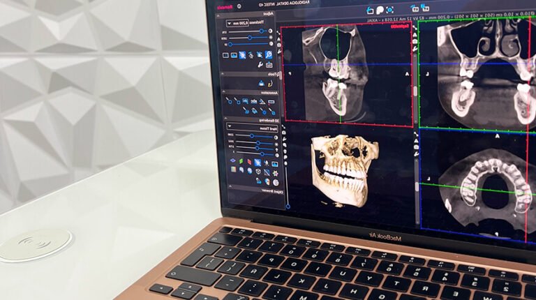 Tomografía 3D - INTEEC