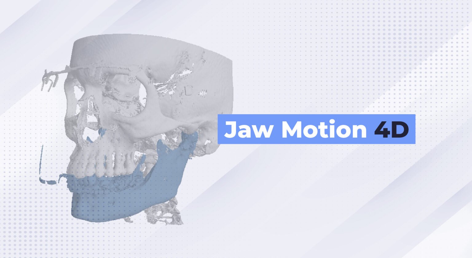 JAW Motion 4D - INTEEC